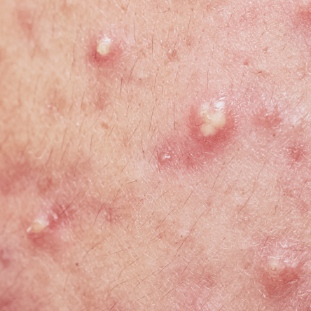 skincare routine quiz – Dermalogica South Africa